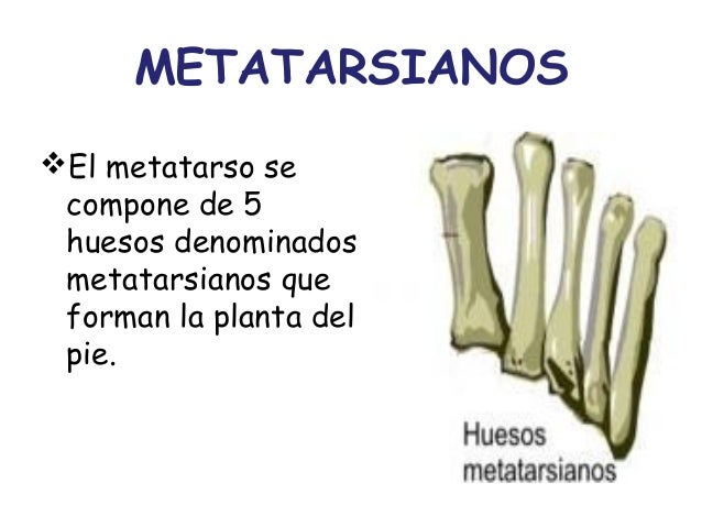 Huesos Del Pie Metatarsianos Metatarsalgia » Franklin, TN