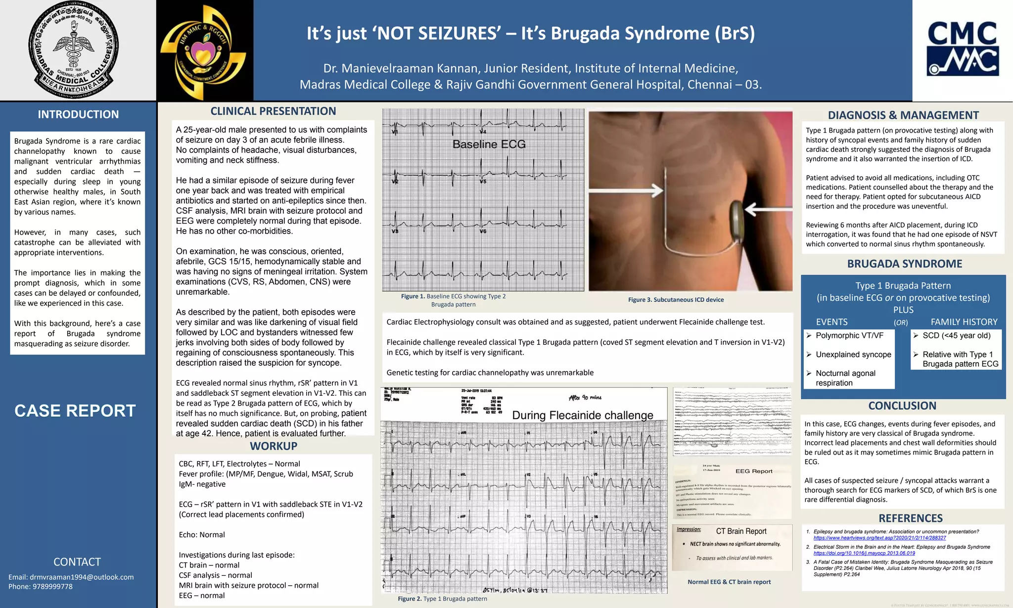 Brugada Syndrome - A Cardiac Channelopathy: Case Report | PPTX