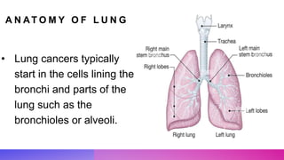 Lung cancer | PPTX