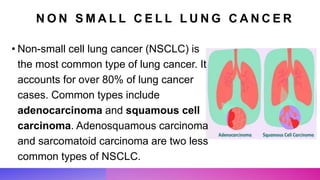 Lung cancer | PPTX