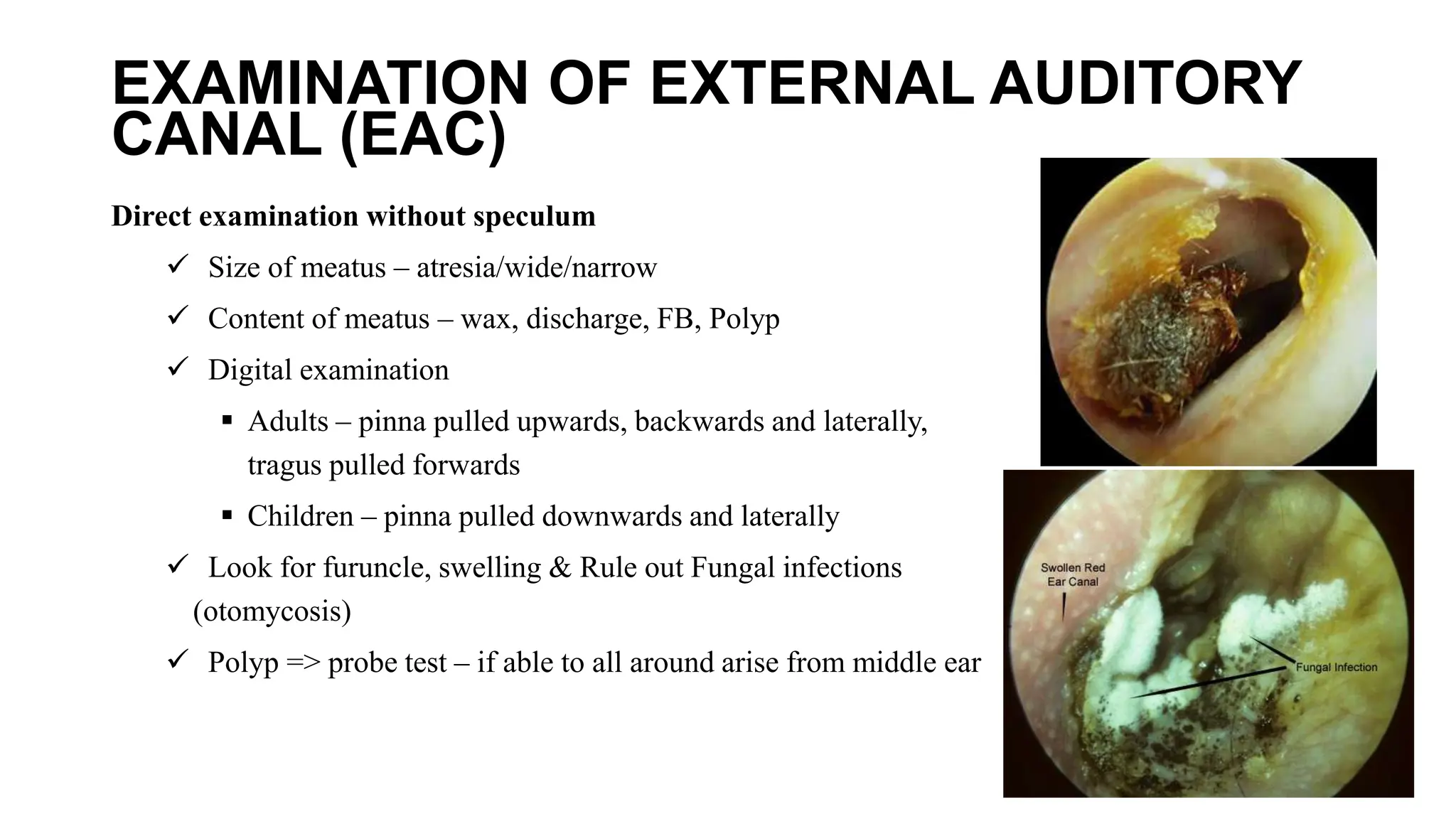 Clinical features of Ear nose and throat | PPTX