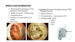 Clinical features of Ear nose and throat | PPTX