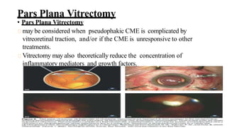 C M E ophthalmology book assessment .pptx