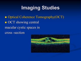 CME - dr AJAY dudani | PPT