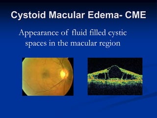 CME - dr AJAY dudani | PPT