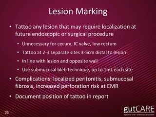 Endoscopic Removal of Colorectal Lesions | PPT