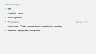 Pseudophakic cystoid macular edema case presentation | PPTX