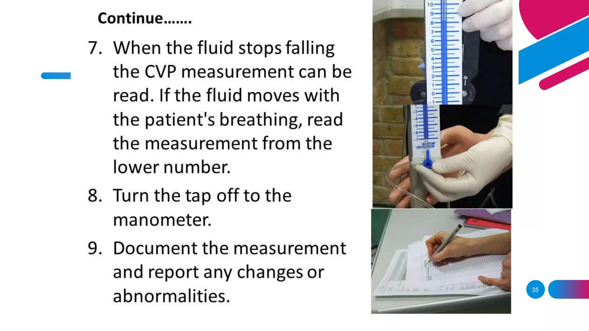 Common surgical procedure | PPT