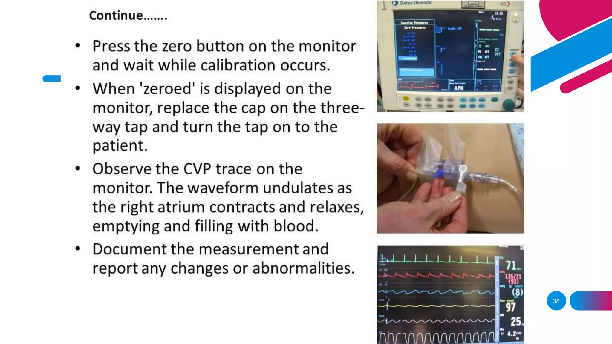 Common surgical procedure | PPT