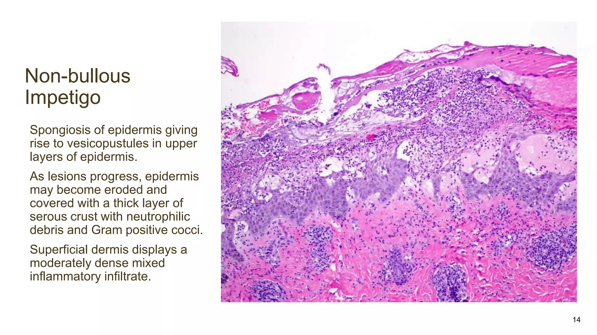 Skin and Soft Tissue Infection.pptx