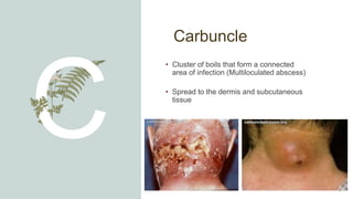 Skin and Soft Tissue Infection.pptx