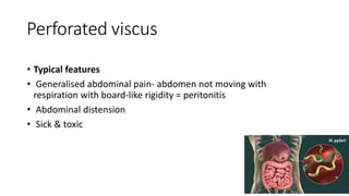 CM1212121212121212112E ACUTE ABDOMEN.pptx