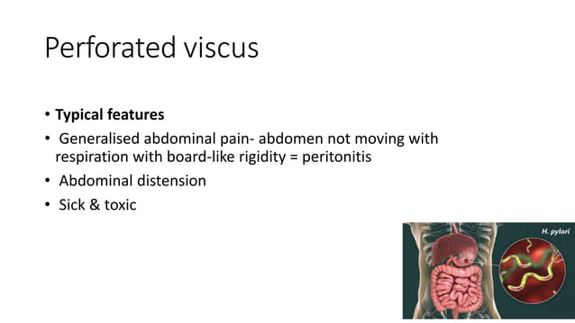 CM1212121212121212112E ACUTE ABDOMEN.pptx