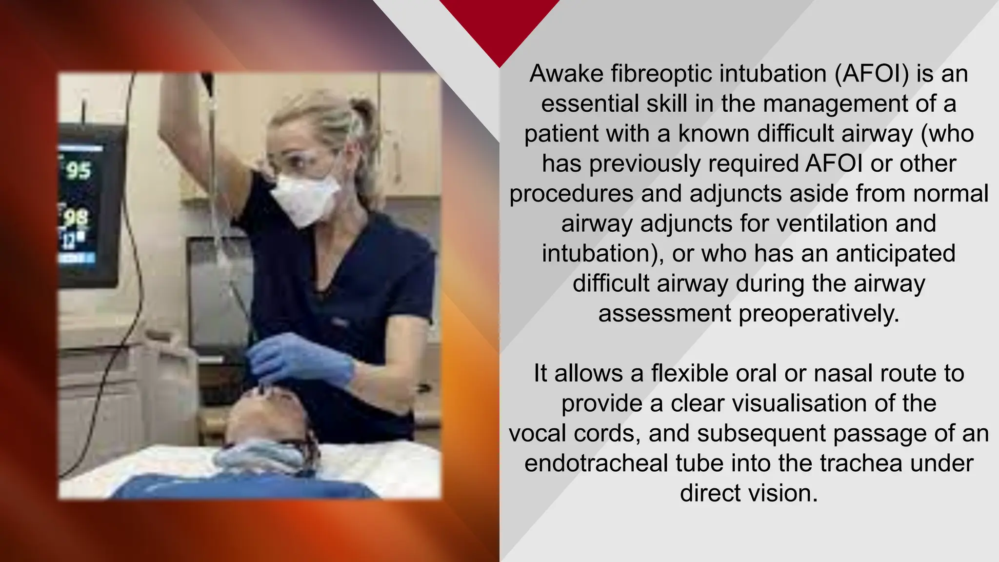 FIBREOPTIC INTUBATION: PRINCIPLES AND TECHNIQUES | PPTX