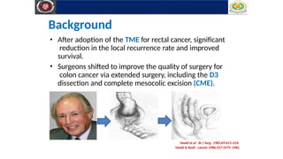 Compwte mesocolic excison and central vascular ligation | PPT