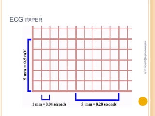 Cardiac monitoring & ECG | PPTX
