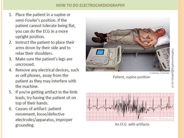 Cardiac monitoring & ECG | PPTX