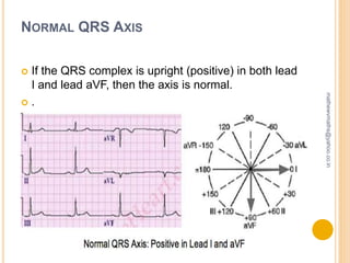 Cardiac monitoring & ECG | PPTX