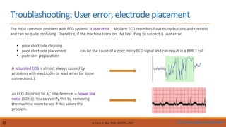 CM ECG Recorder pp.pptx