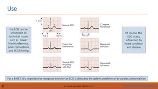 CM ECG Recorder pp.pptx