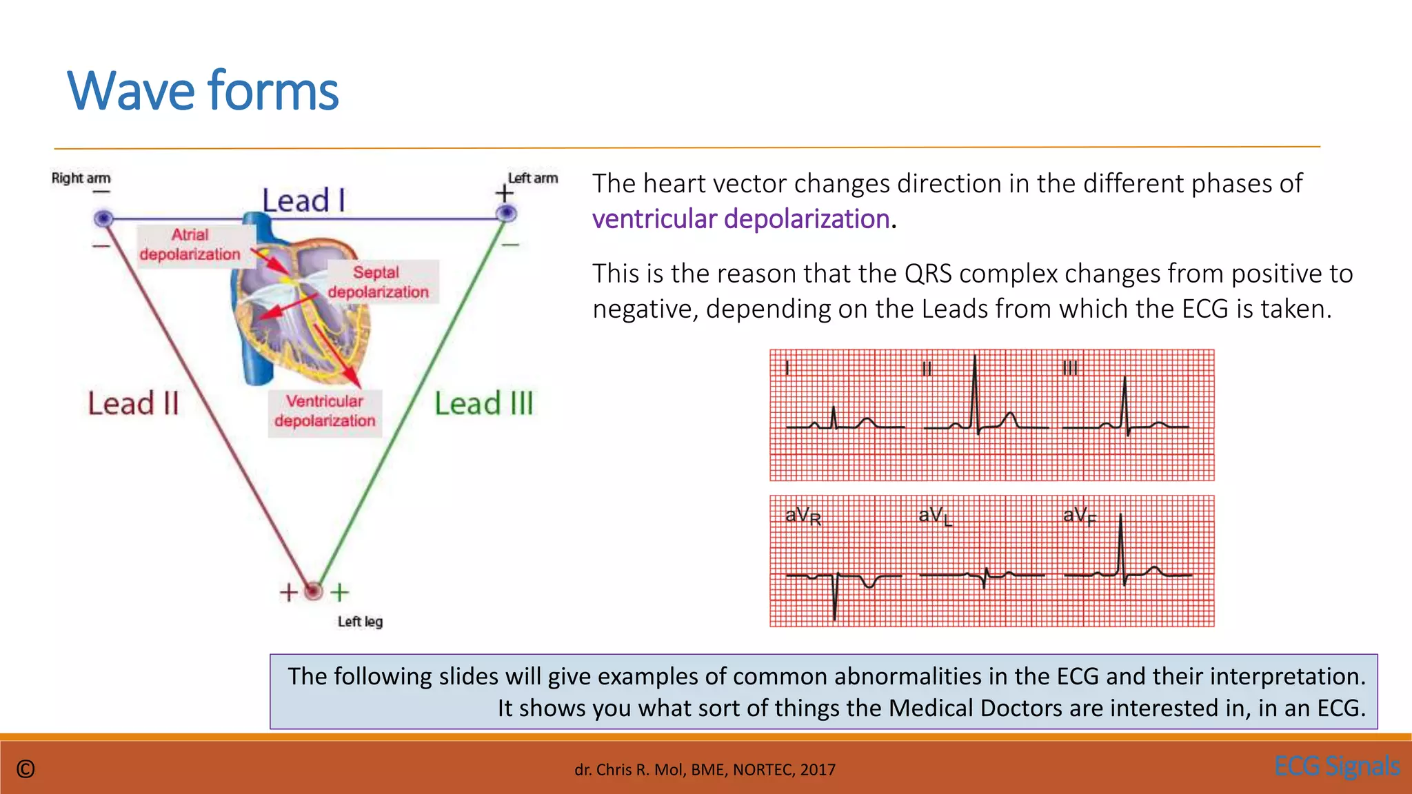 CM ECG Signals pp.pptx