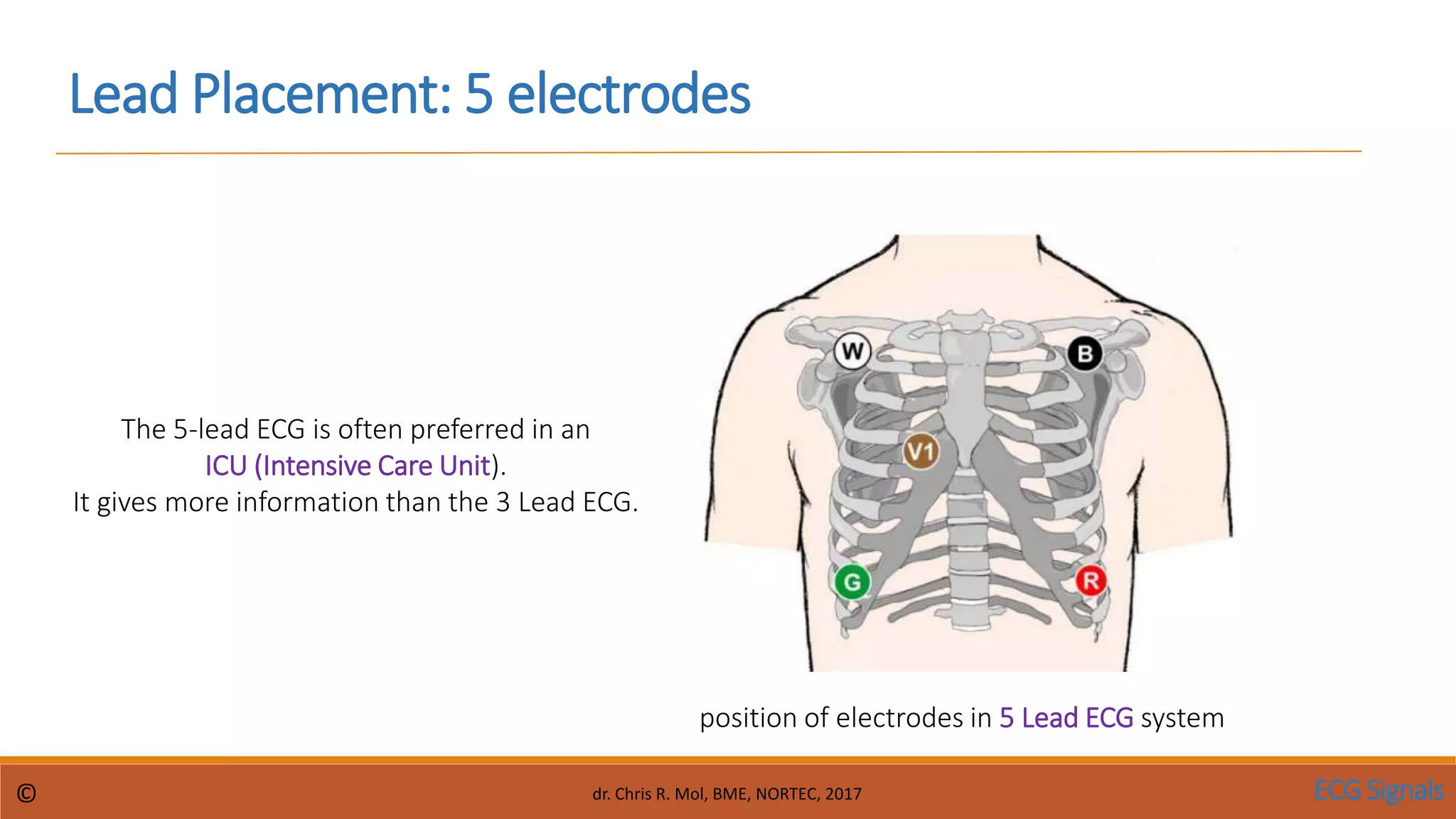 CM ECG Signals pp.pptx