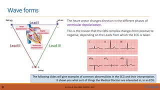 CM ECG Signals pp.pptx