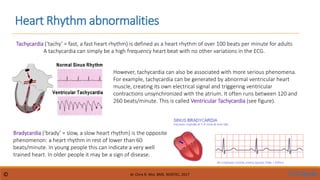 CM ECG Signals pp.pptx