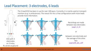 CM ECG Signals pp.pptx