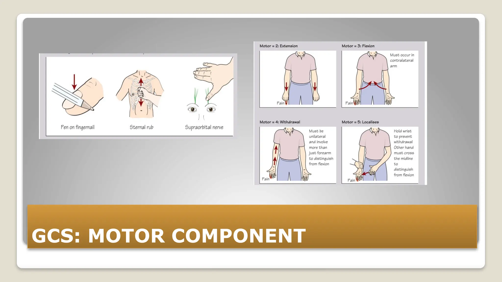 Slide HEAD INJURY (diagnosis,causes, management)-1.pptx