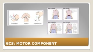 Slide HEAD INJURY (diagnosis,causes, management)-1.pptx | Death, Injury ...