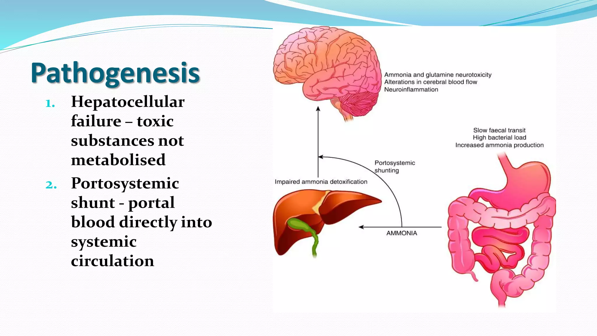 Hepatic encephalopathy | PPTX | Digestive Disorders | Diseases and ...