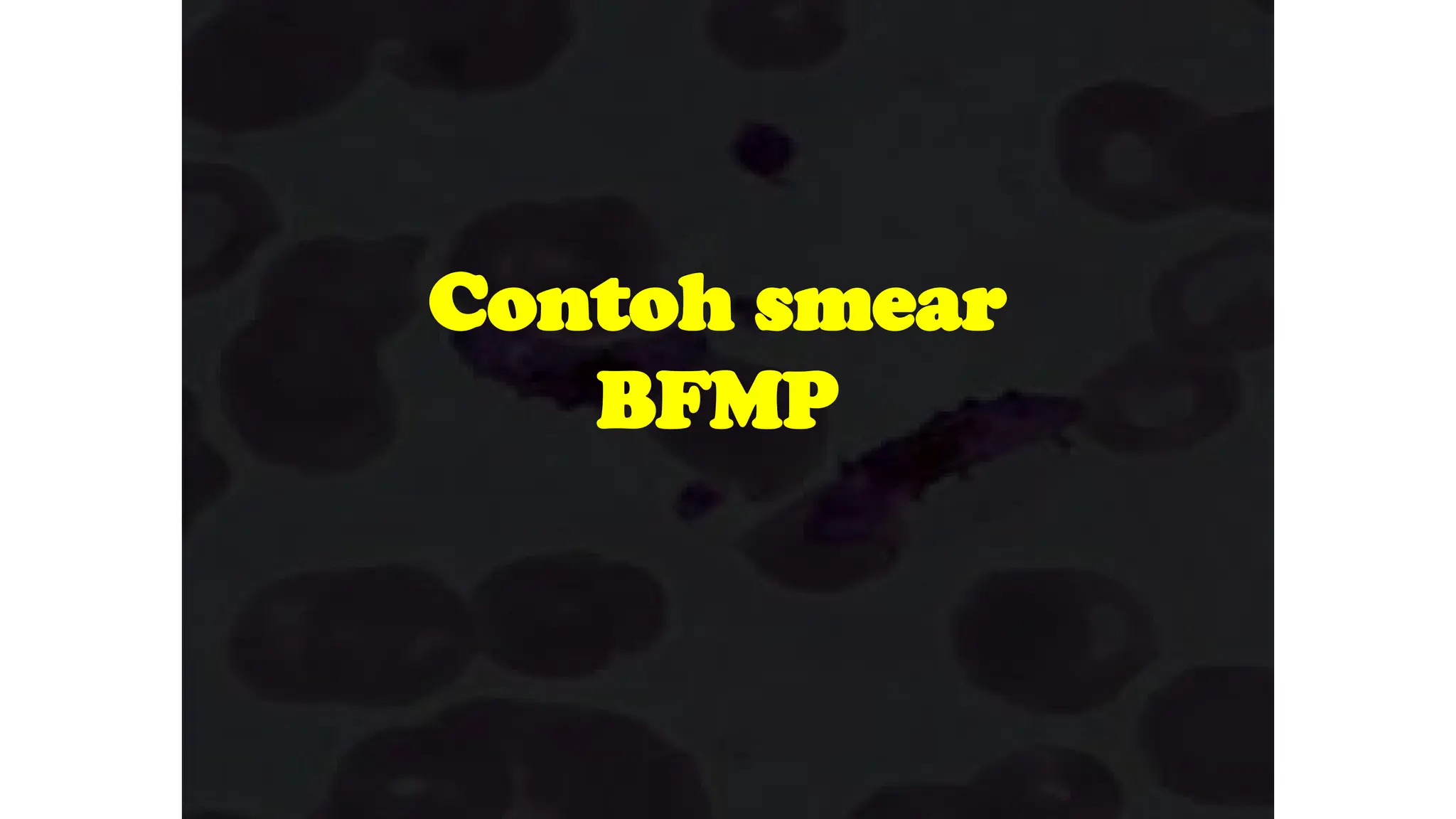 blood film malaria parasite collection, transportation & slide ...