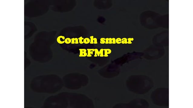 blood film malaria parasite collection, transportation & slide ...