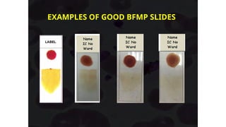 blood film malaria parasite collection, transportation & slide ...