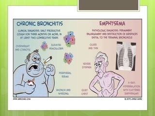 CM emphysema .pptx