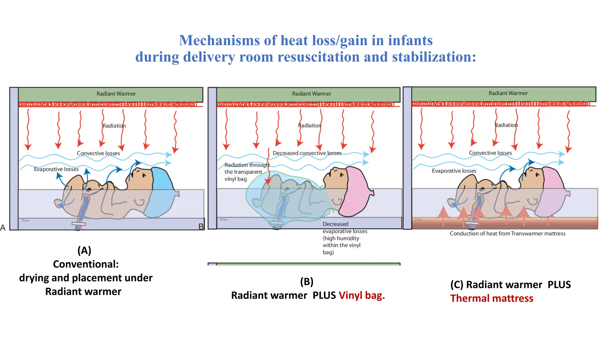 Neonatal Resuscitation by Dr Gabriel 2023 | PDF