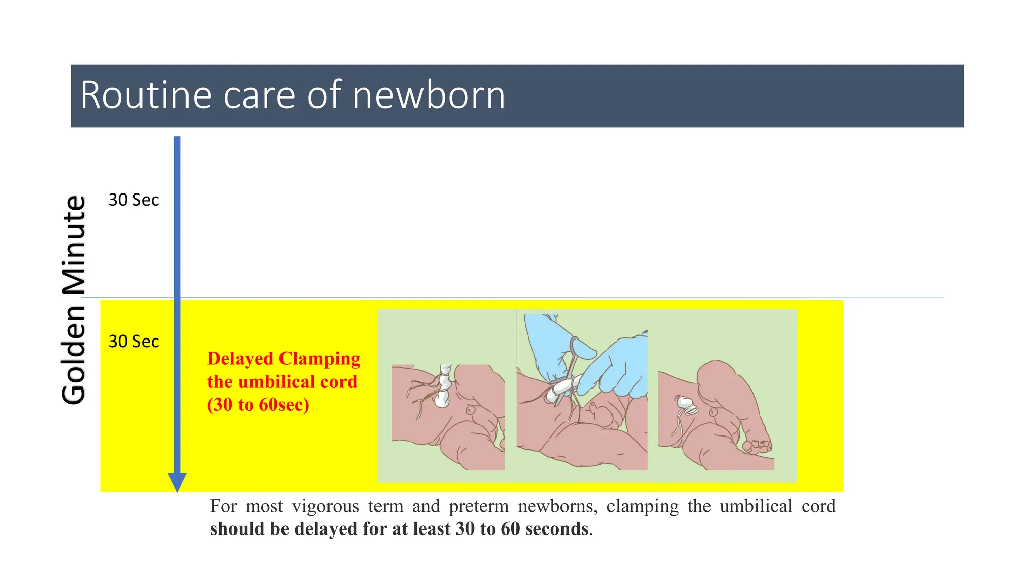 Neonatal Resuscitation by Dr Gabriel 2023 | PDF