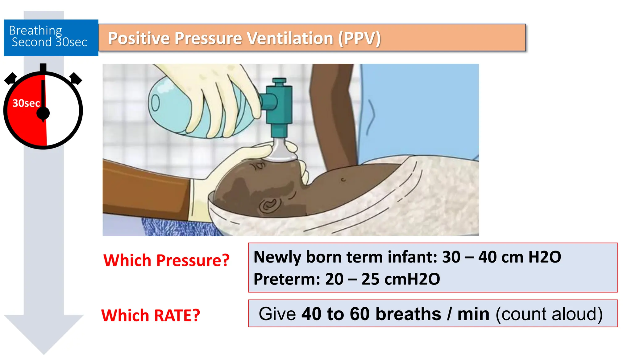 Neonatal Resuscitation by Dr Gabriel 2023 | PDF