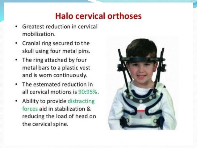 classification and managenement of paediatric craniocervical junction…