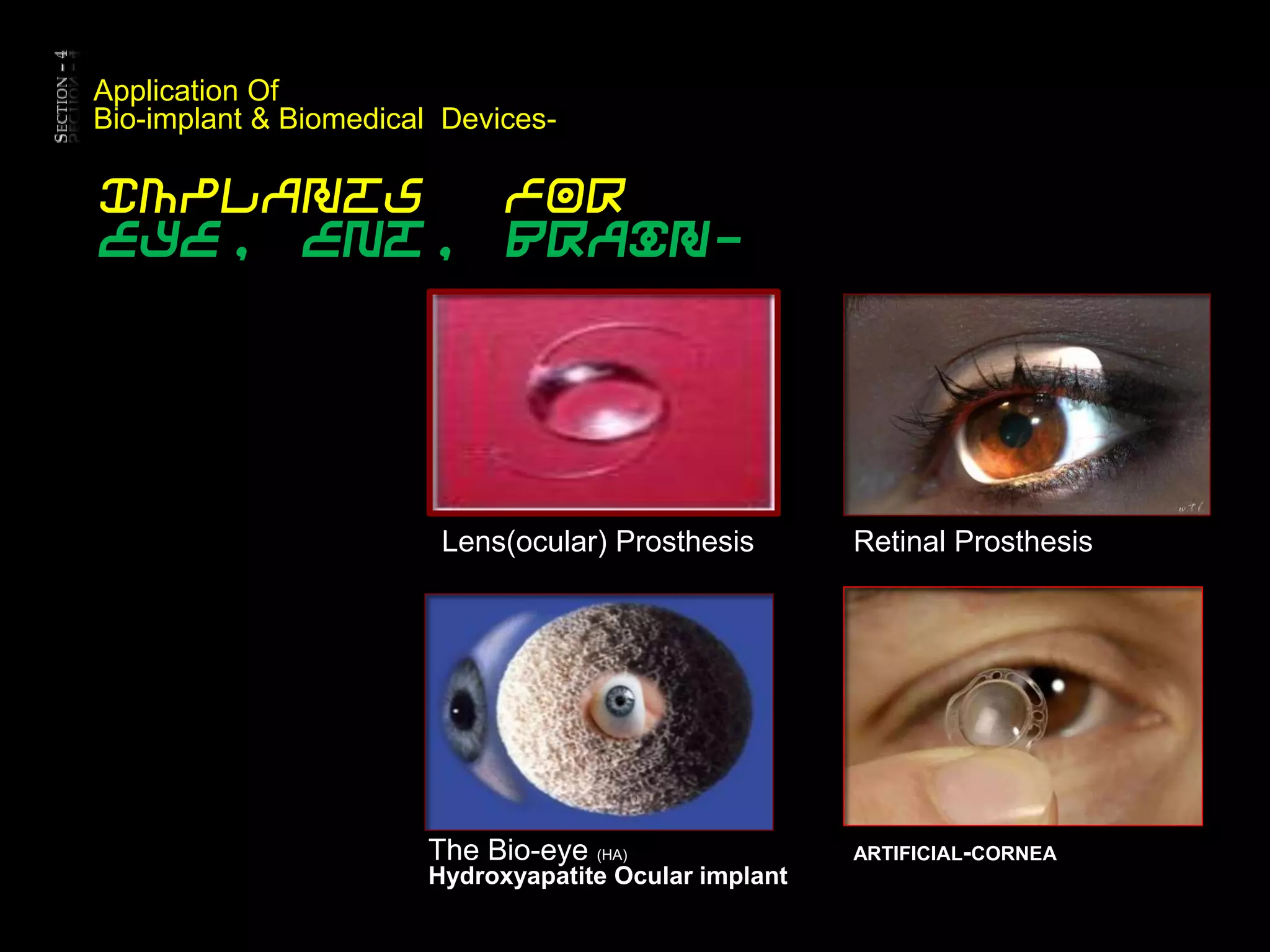 Basics of- HUMAN BIOMATERIALS, IMPLANTABLE MEDICAL DEVICES AND ...