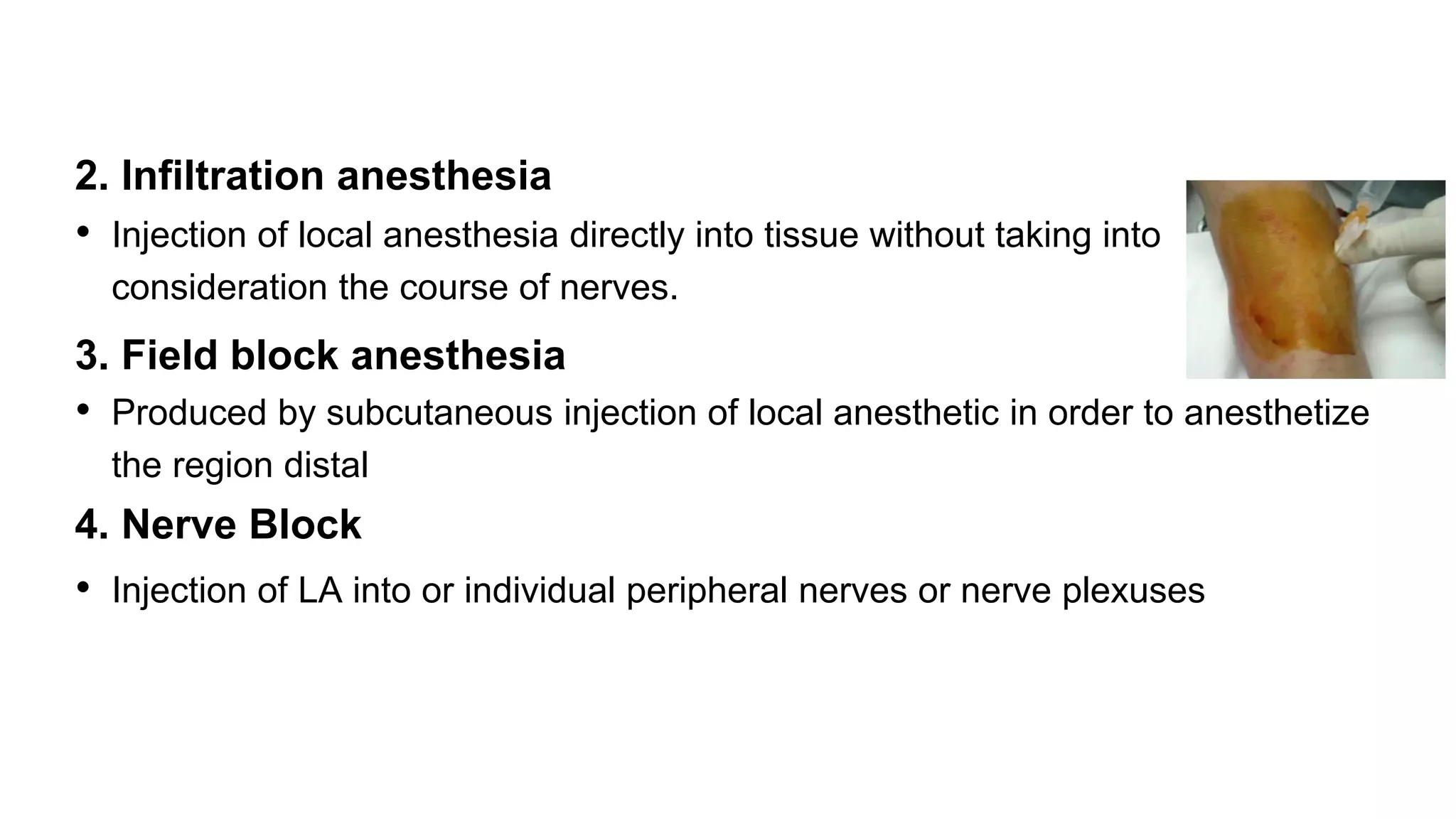 CME PERIPHERAL BLOCK.pptx