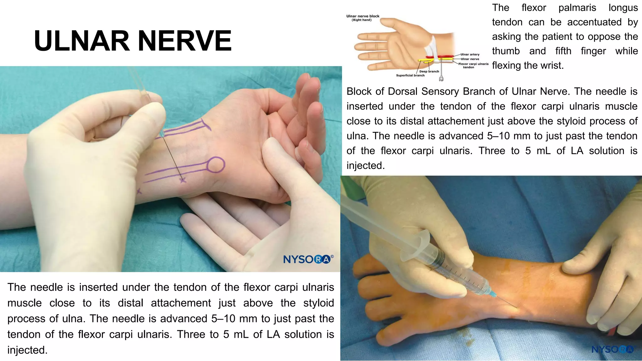 CME PERIPHERAL BLOCK.pptx