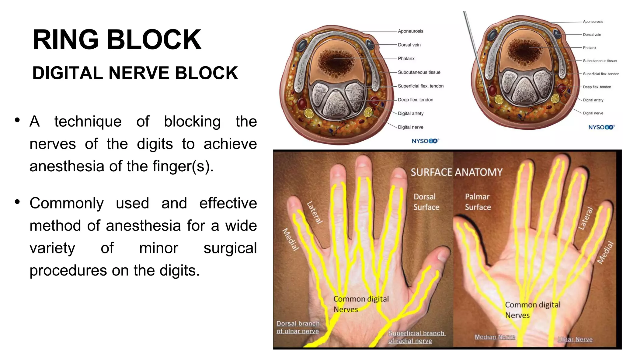 CME PERIPHERAL BLOCK.pptx