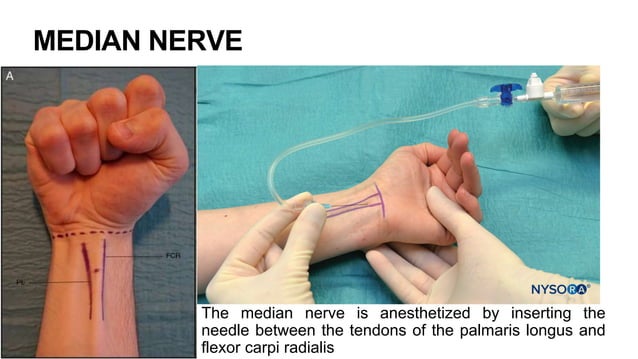 CME PERIPHERAL BLOCK.pptx