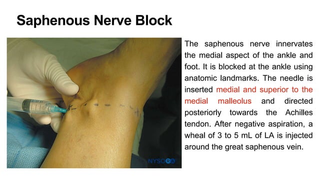 CME PERIPHERAL BLOCK.pptx