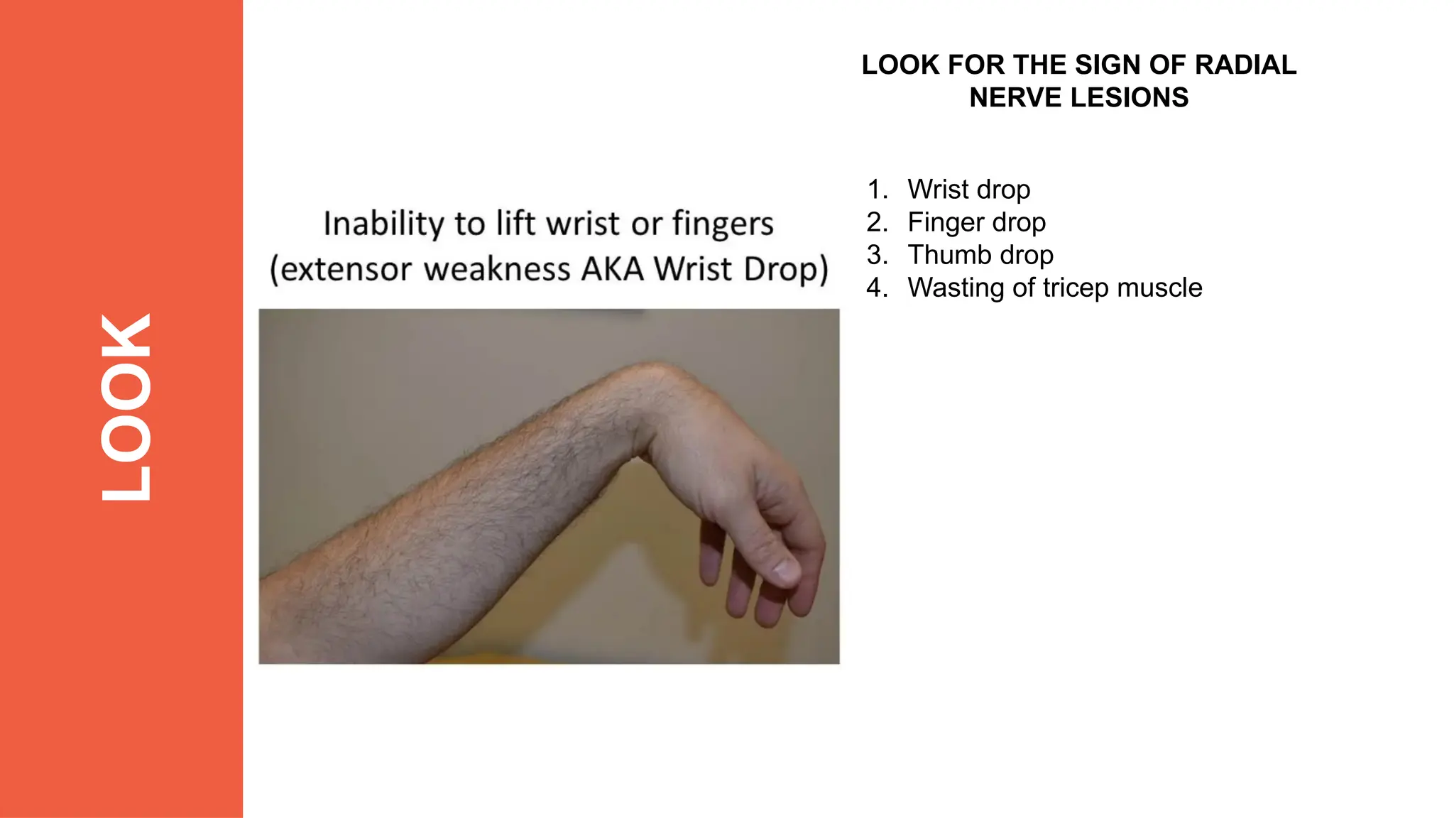Peripheral nerve examination of upper limb.pptx