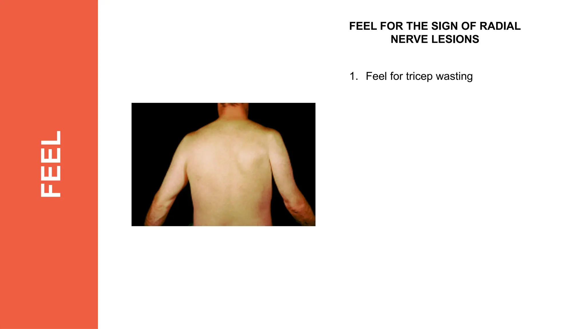 Peripheral nerve examination of upper limb.pptx