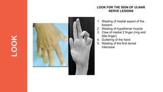 Peripheral nerve examination of upper limb.pptx