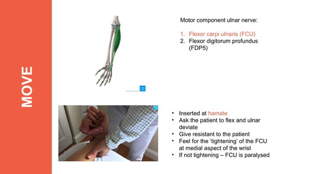 Peripheral nerve examination of upper limb.pptx